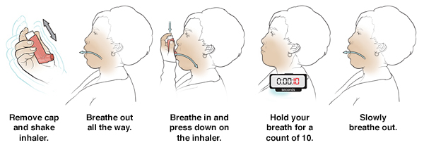 Using an Inhaler | YourCareEverywhere