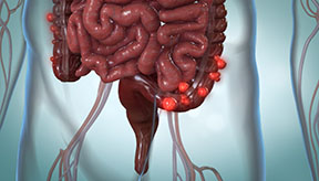 Video LIbrary | Cedars-Sinai