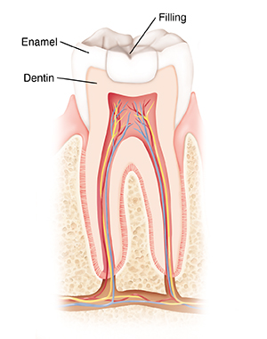 Understanding Tooth Decay | Saint Luke's Health System