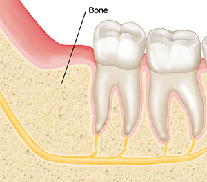 Wisdom Teeth Surgery- Your Recovery | Saint Luke's Health System
