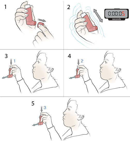 Step By Step Priming Your Inhaler Saint Lukes Health System