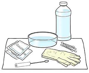 Discharge Instructions: Caring for Your Tracheostomy Tube and Stoma ...
