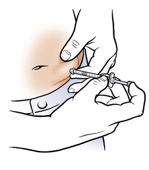 Giving a Subcutaneous (Sub-Q) Injection (Single Medicine) | Saint Luke ...