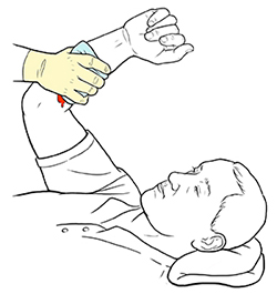 First Aid: Bleeding | Saint Luke's Health System