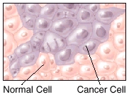 Understanding Radiation Therapy | Saint Luke's Health System