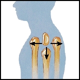 Understanding Shoulder Instability | Saint Luke's Health System